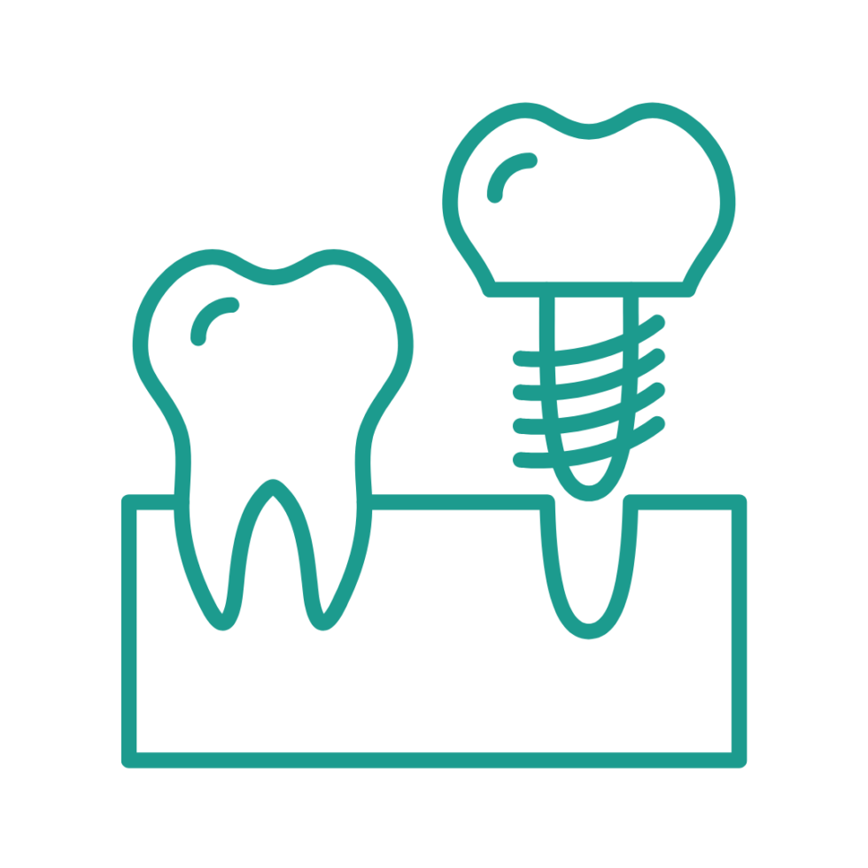 Dental Implants | Jones Family and Cosmetic Dentistry